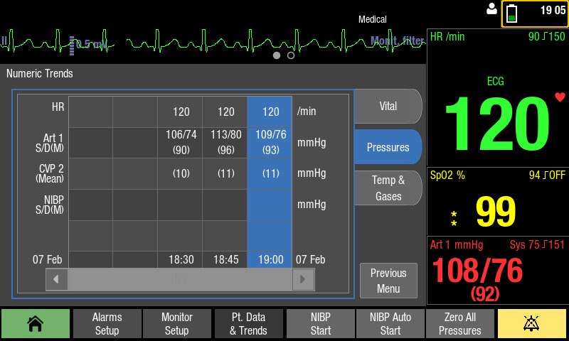 CARESCAPE ONE Monitor | Patient Monitoring | GE Healthcare