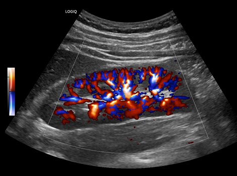 LOGIQ™ E10 Ultrasound | GE Healthcare