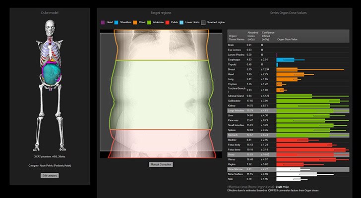 DoseWatch™| Digital Solutions | GE Healthcare