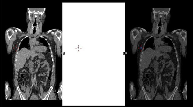 Clinical Image Library - Optima NM/CT 640 - GENERAL PURPOSE HYBRID ...
