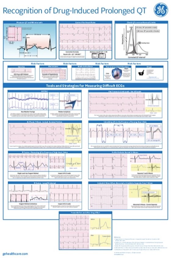 Diagnostic ECG | GE Healthcare