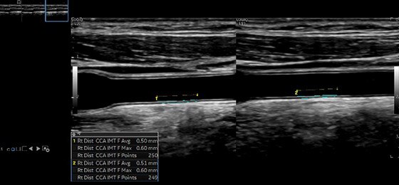 LOGIQ™ E10 Ultrasound | GE Healthcare