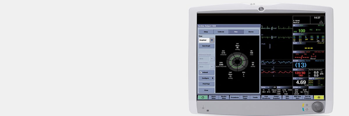 E-PiCCO - Patient Monitors - Patient Monitoring - Categories | GE ...