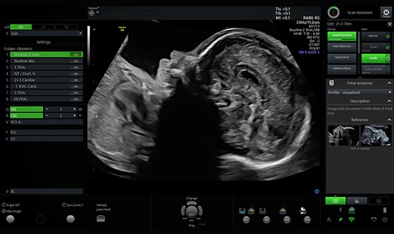 Voluson S8 with Touch Panel | GE Healthcare