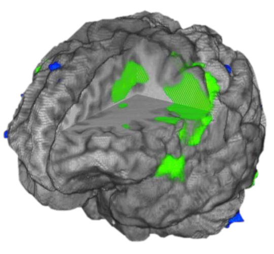 BrainWave | GE Healthcare