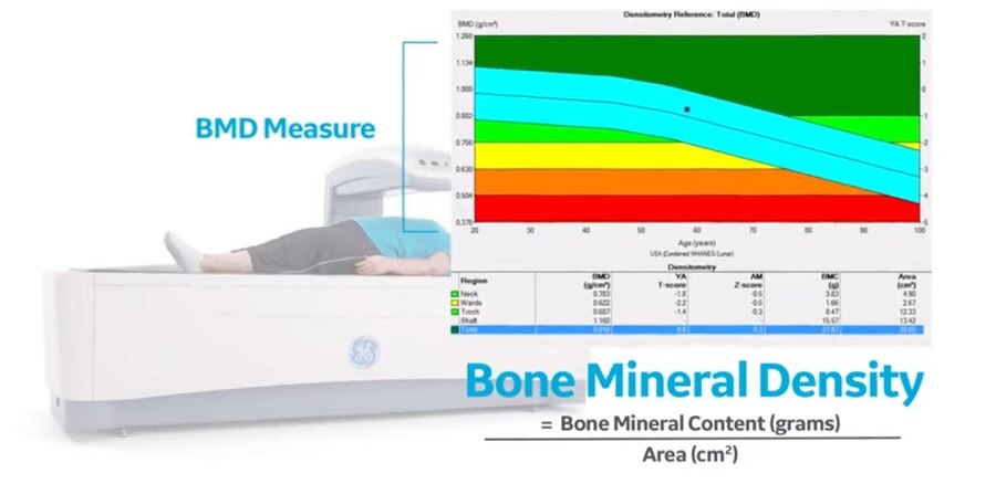 enCORE Software Platform | GE Healthcare