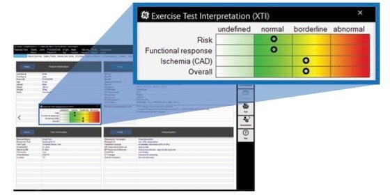 CardioSoft Cardiac Testing System | GE Healthcare