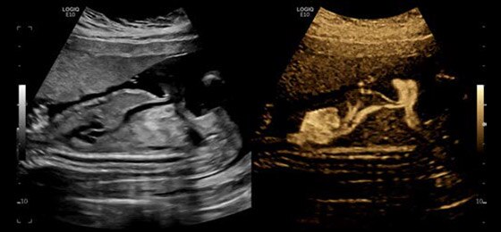 LOGIQ™ E10 Ultrasound | GE Healthcare