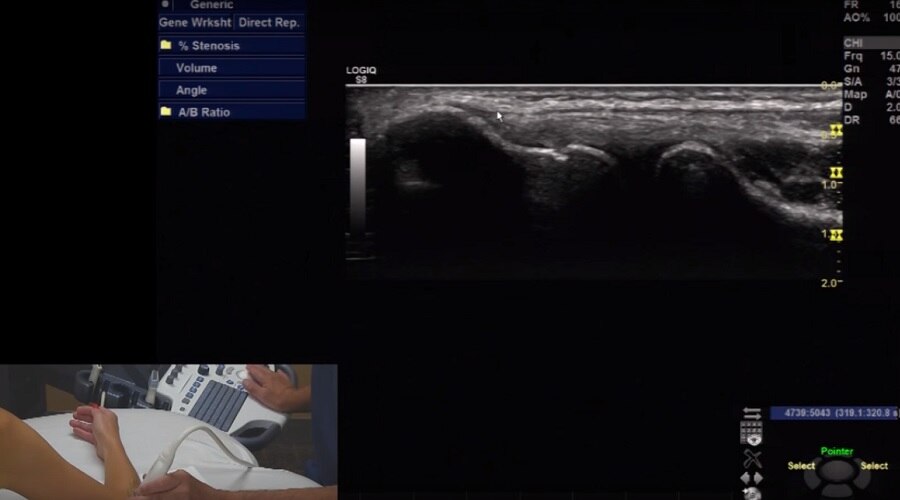 MSK Upper Extremity | GE Healthcare