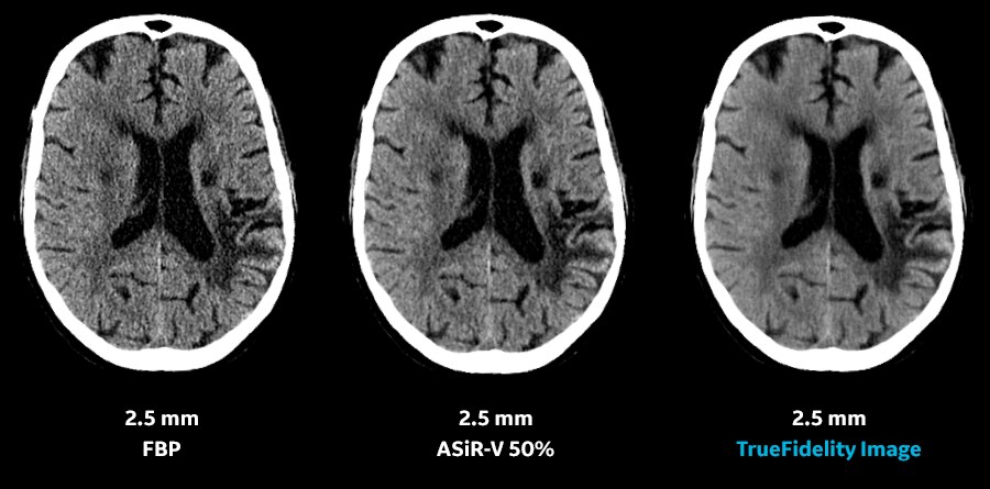 TrueFidelity CT | GE Healthcare