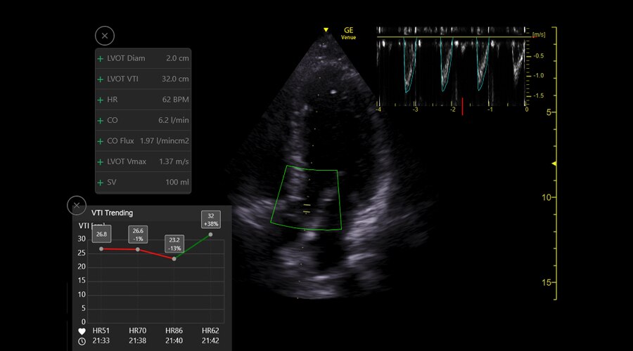 Venue Go™ | GE Healthcare