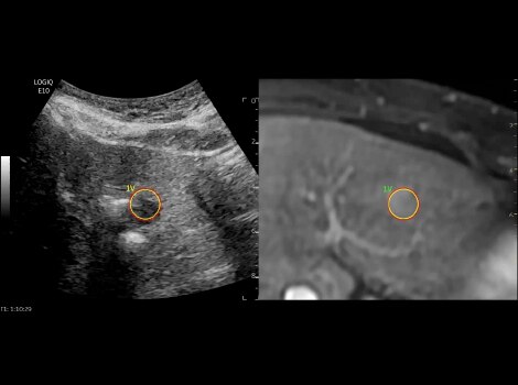 LOGIQ™ E10 Ultrasound | GE Healthcare