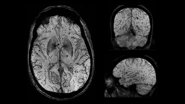 SWAN | GE Healthcare