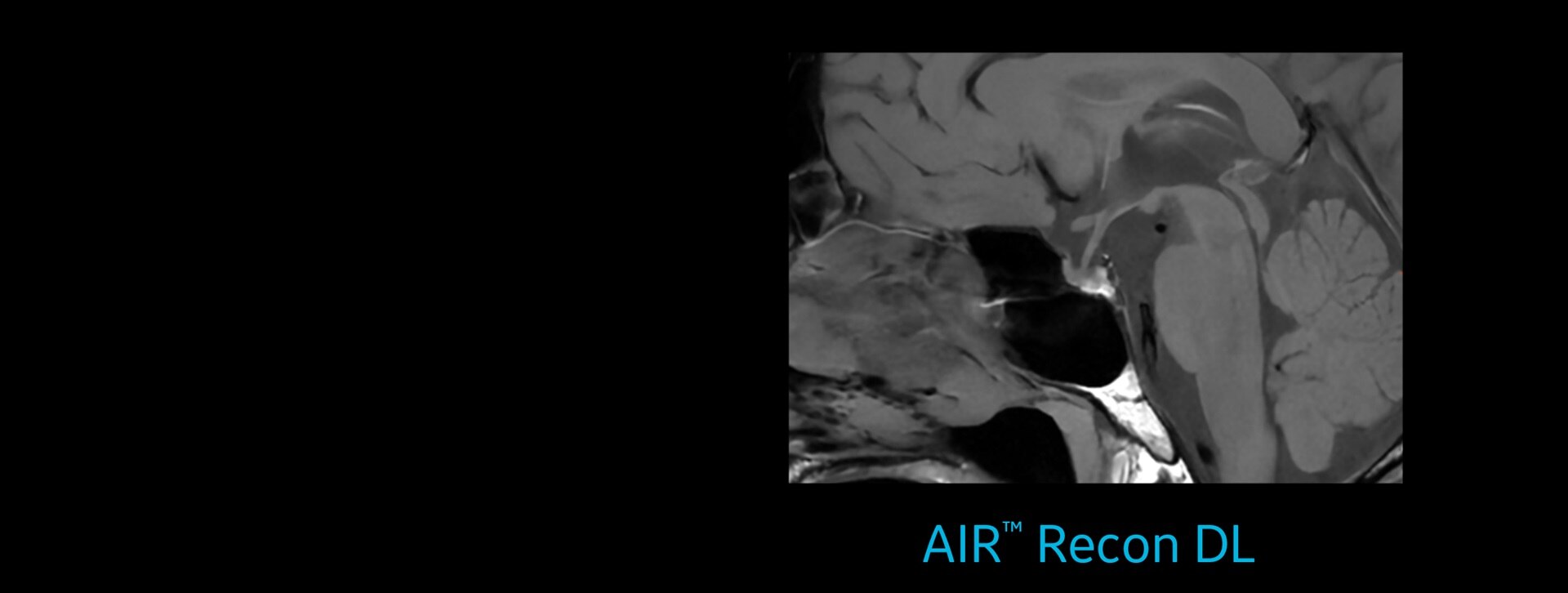 Magnetic Resonance Imaging | GE Healthcare | GE Healthcare