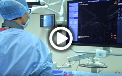 Discovery IGS 730 for Hybrid OR | GE Healthcare