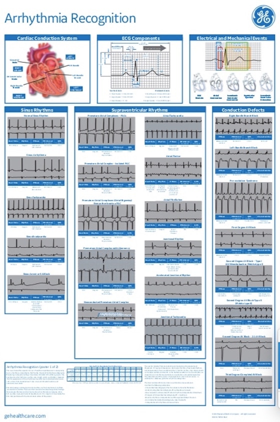Diagnostic ECG | GE Healthcare