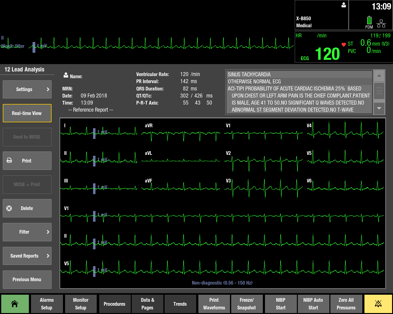 CARESCAPE B650 | Patient Monitoring | GE Healthcare