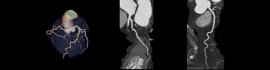 TrueFidelity CT | GE Healthcare