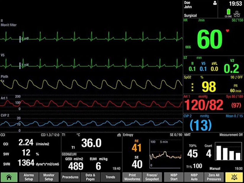 CARESCAPE B450 | Patient Monitoring | GE Healthcare