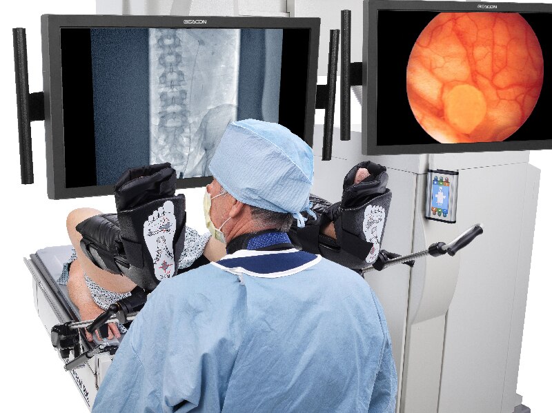 Uroview 8K | GE Healthcare