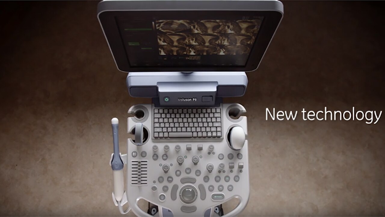 LOGIQ F8 | GE Healthcare