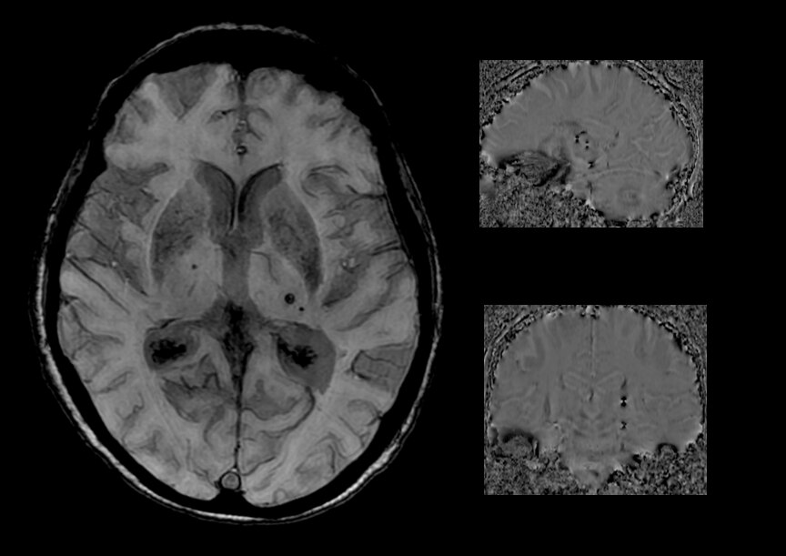 SWAN | GE Healthcare