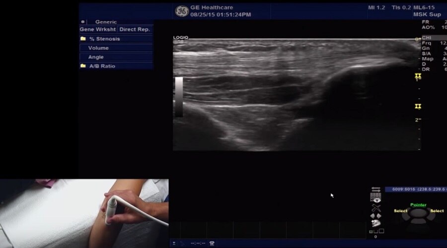 MSK Upper Extremity | GE Healthcare