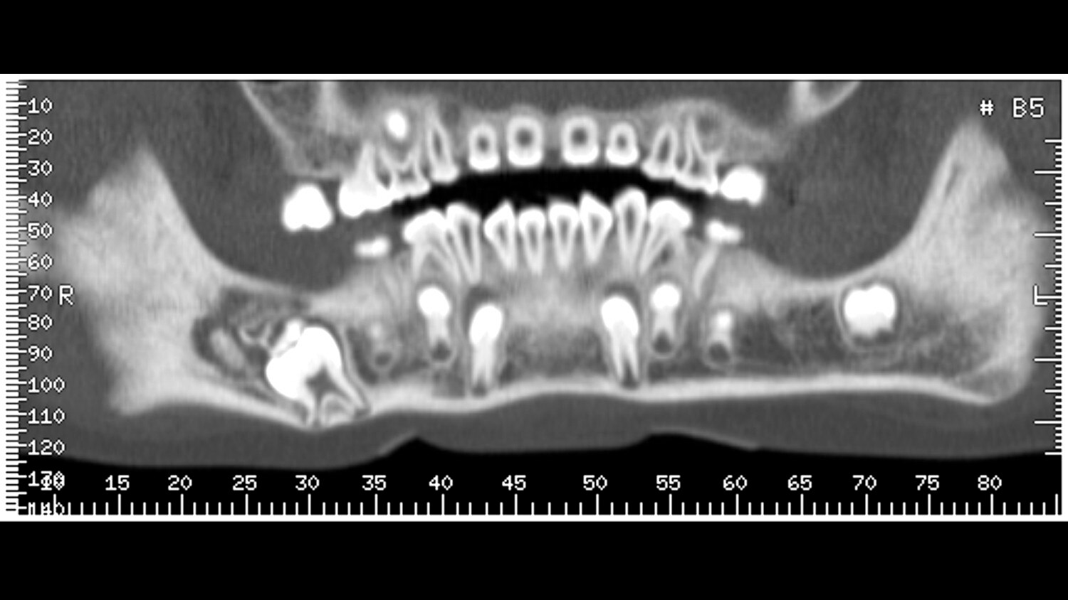 DentaScan | GE Healthcare