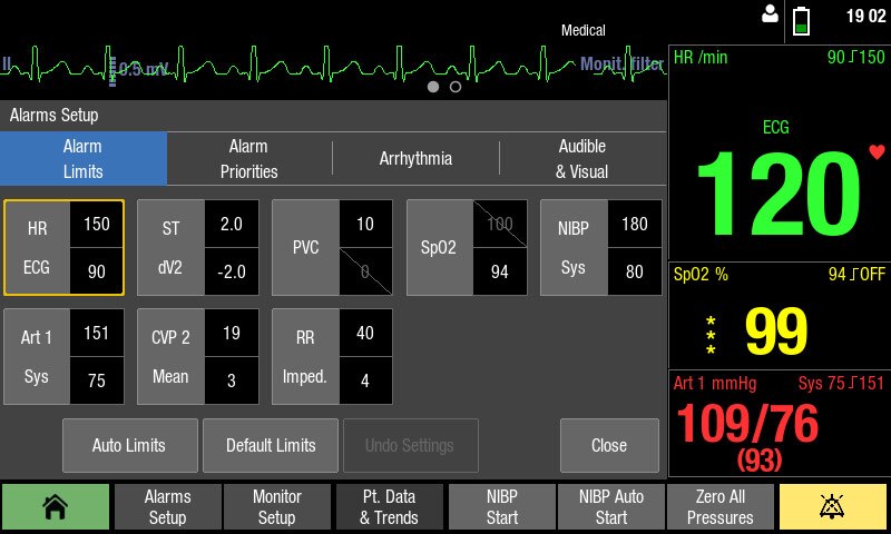 CARESCAPE ONE Monitor | Patient Monitoring | GE Healthcare