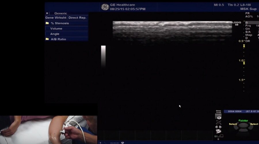 MSK Upper Extremity | GE Healthcare