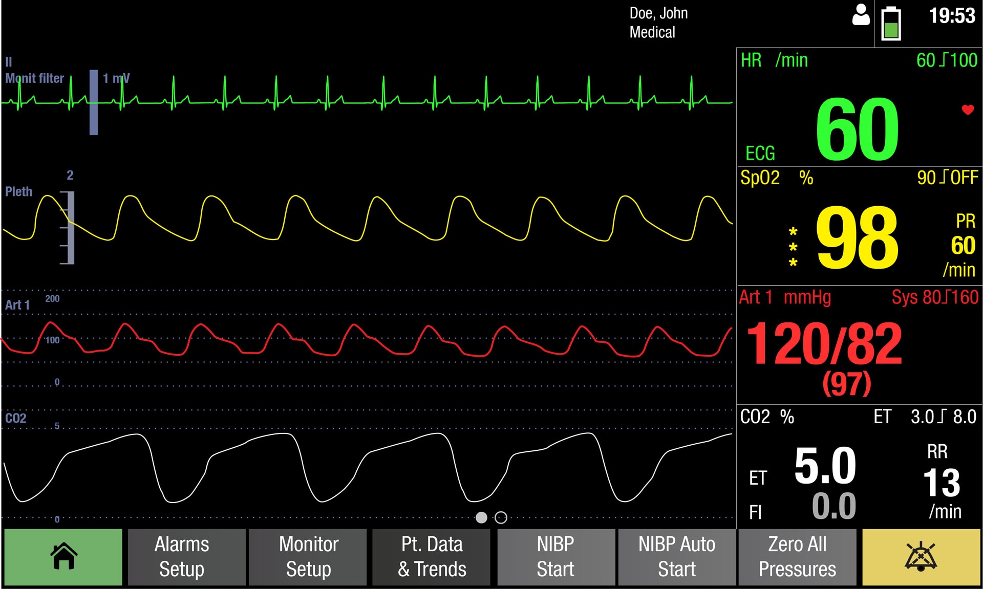 CARESCAPE ONE Monitor | Patient Monitoring | GE Healthcare