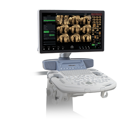 2d 3d And 4d Ultrasound Voluson S8 Voluson Signature Series Ge