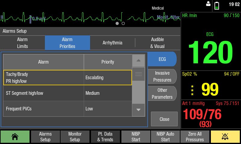 CARESCAPE ONE Monitor | Patient Monitoring | GE Healthcare