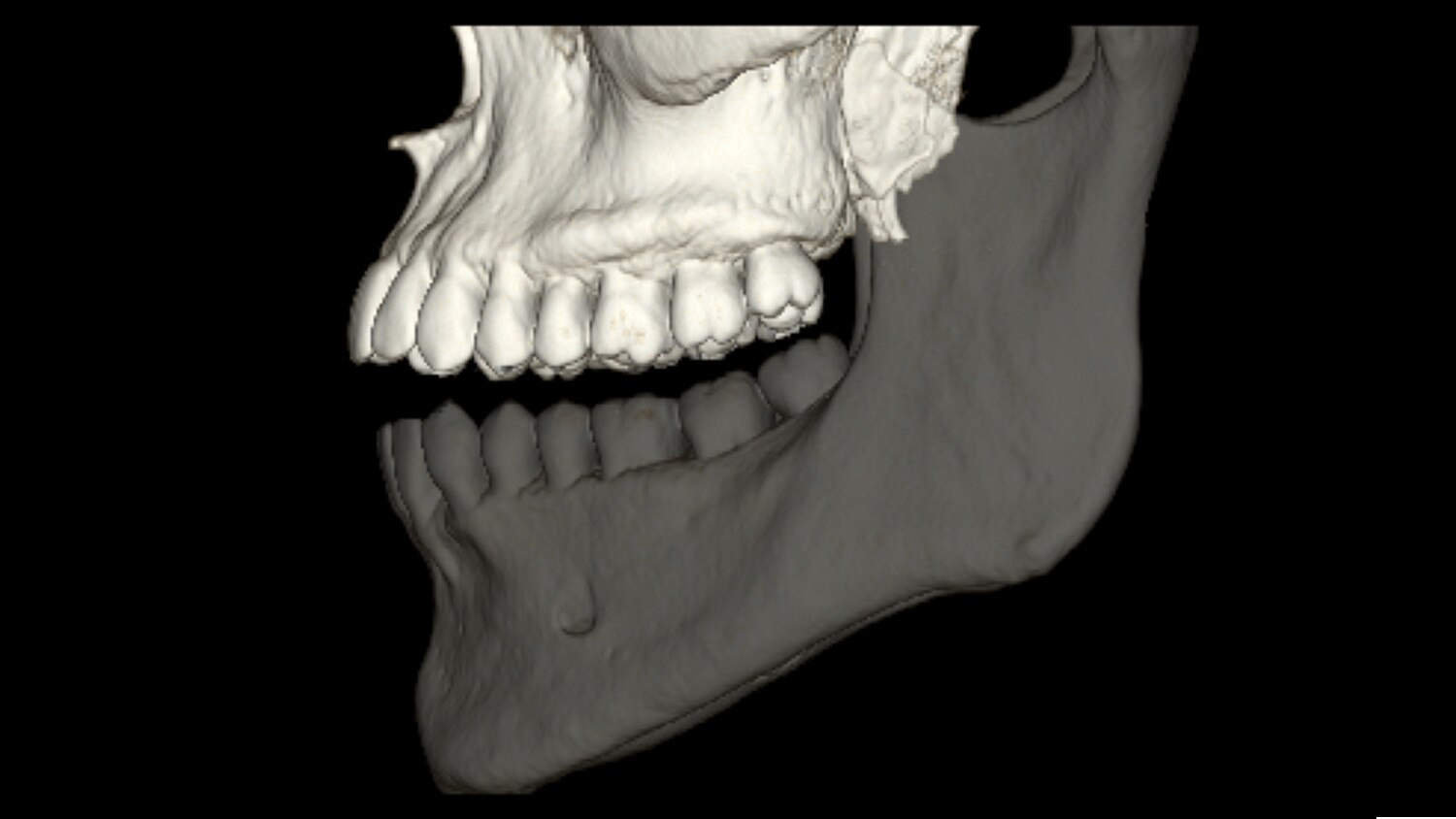DentaScan | GE Healthcare