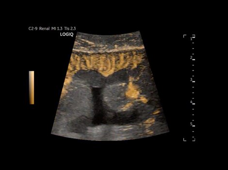 LOGIQ™ E10 Ultrasound | GE Healthcare