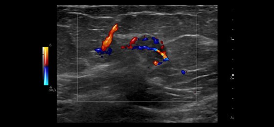 LOGIQ™ E10 Ultrasound | GE Healthcare