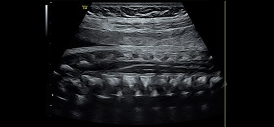 Voluson S10 | OB/GYN Ultrasound Machine | GE Healthcare (United States)