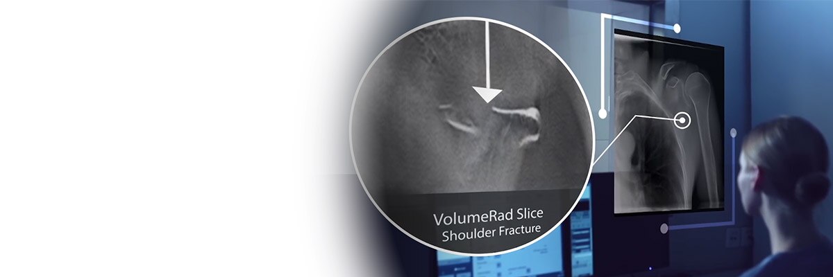 Advanced Applications | GE HealthCare (United States)