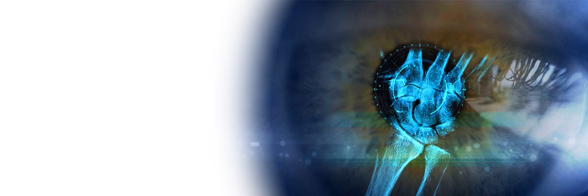 Fluoroscopy Systems | GE Healthcare (United States)