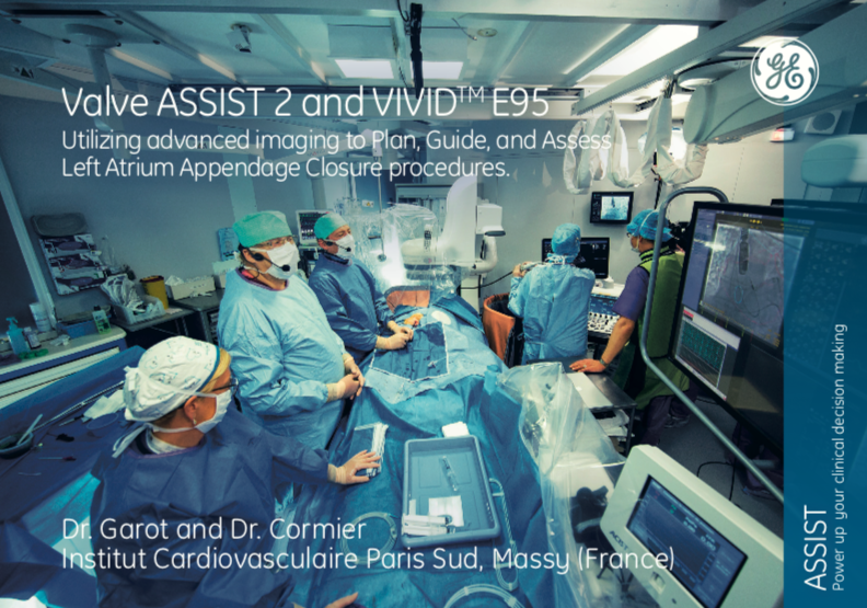 Valve ASSIST for Interventional Image Guided Systems | GE HealthCare ...