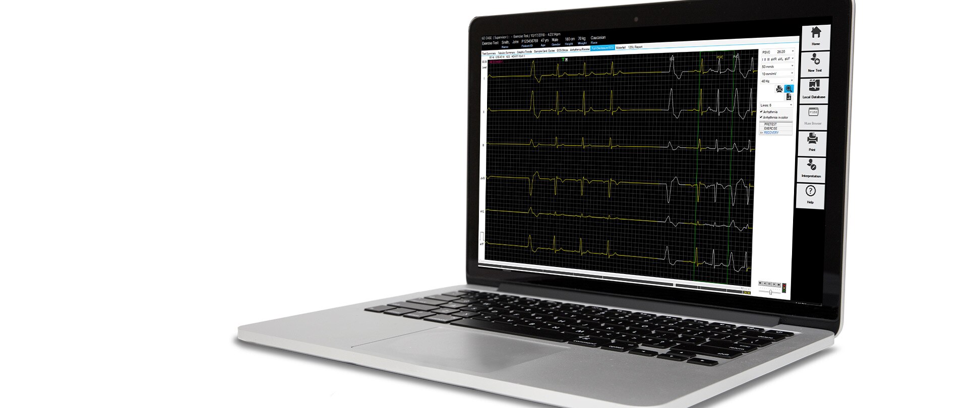 CardioSoft-v7-sp7 | GE HealthCare (United States)