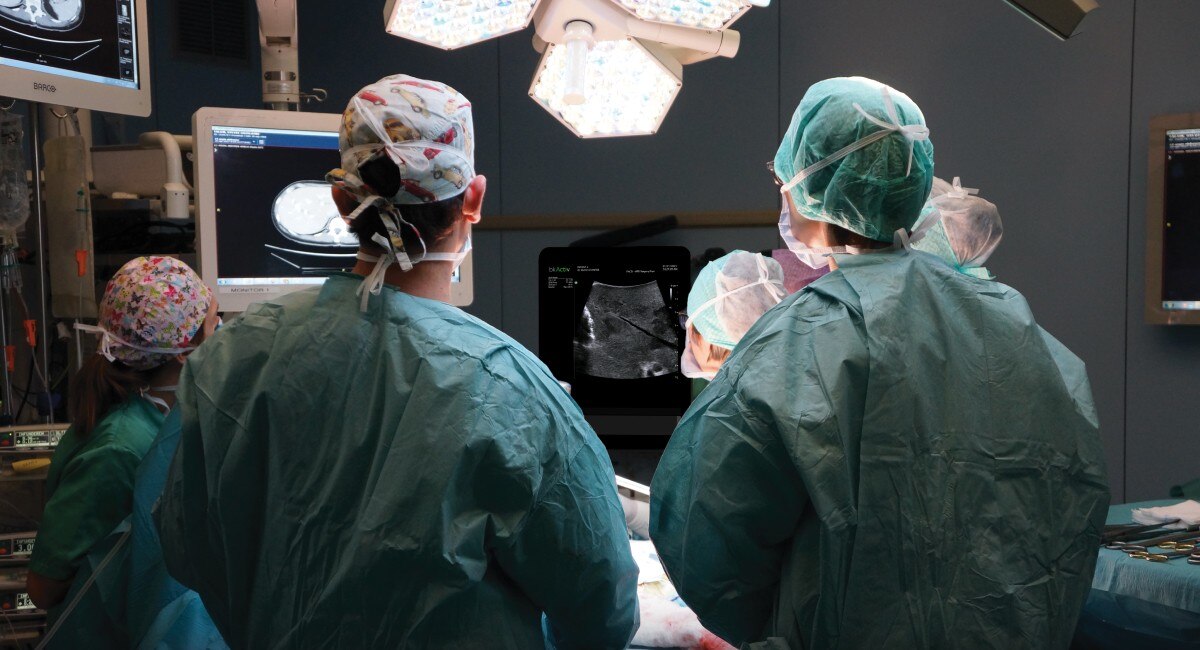 Intraoperative Ultrasound for General Surgery | GE HealthCare (United ...