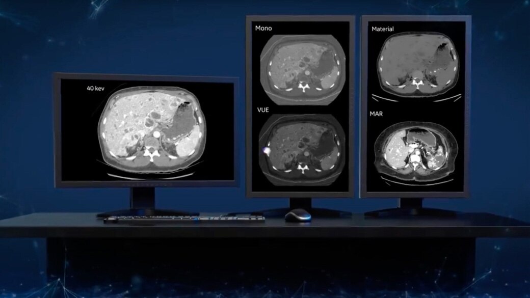 Revolution™ Apex Platform | GE Healthcare (United States)