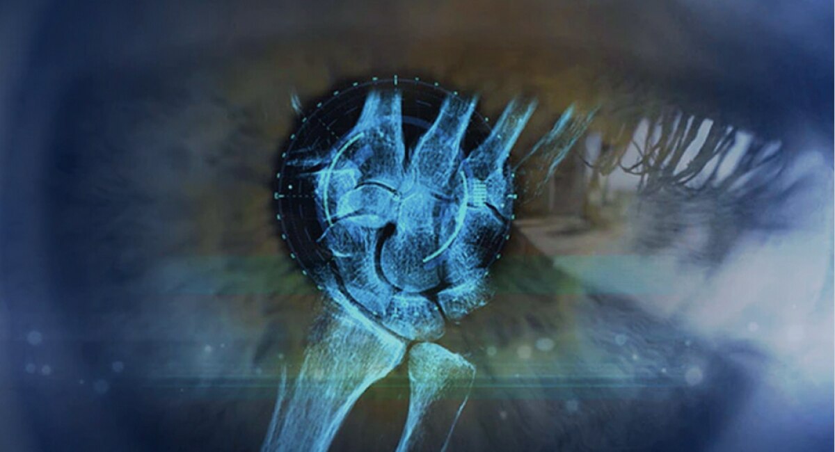 Fluoroscopy Systems | GE HealthCare (United States)