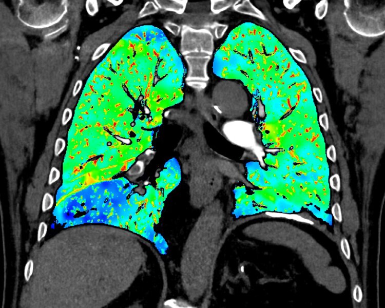 Imaging Clinical Cases | GE HealthCare (United States)