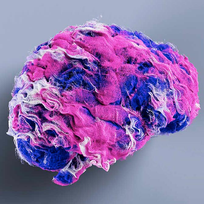 MR image reconstruction with AIR Recon DL | GE HealthCare (United States)