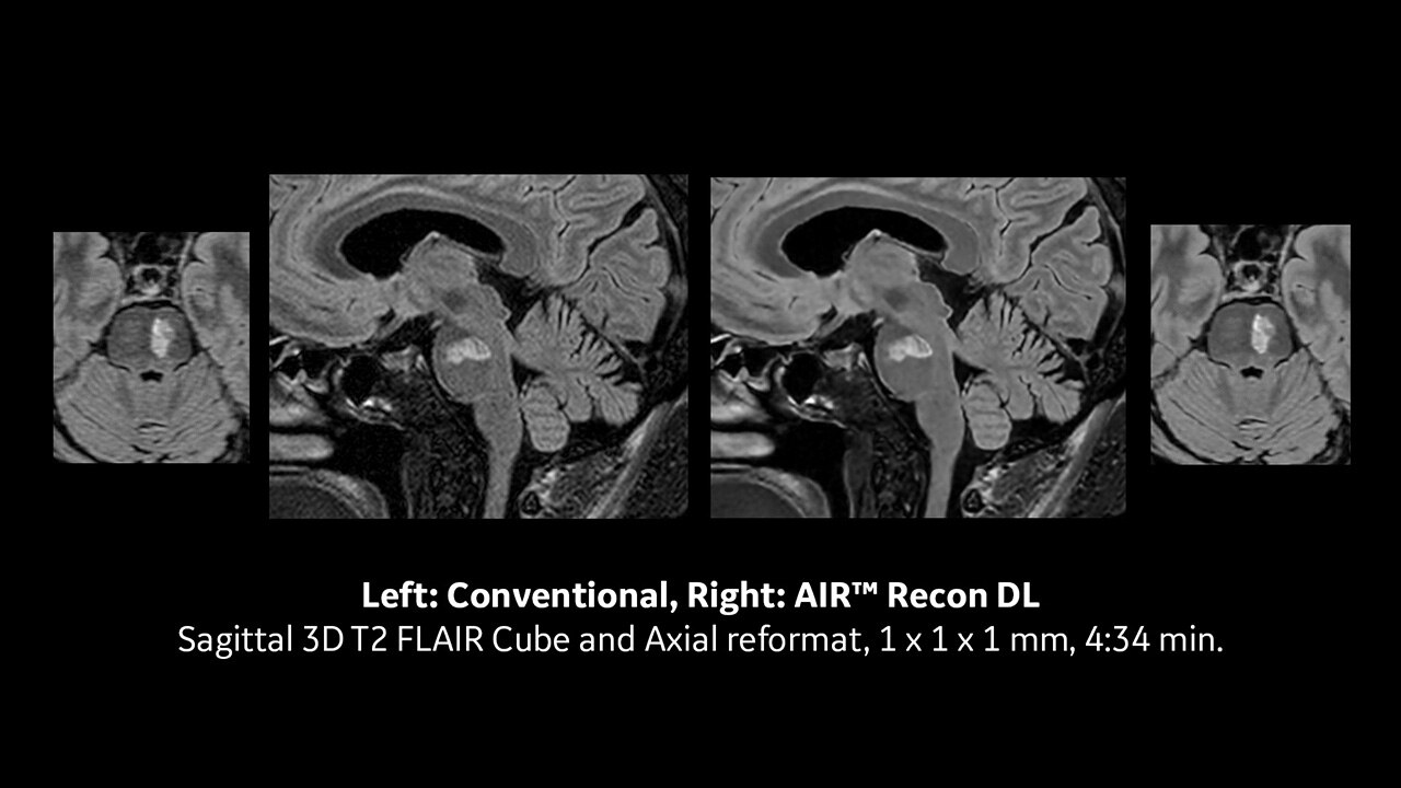 MR 30 for SIGNA clinical images | GE Healthcare (United States)