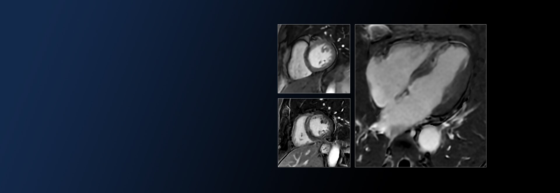 Magnetic Resonance Imaging | GE Healthcare | GE Healthcare (United States)