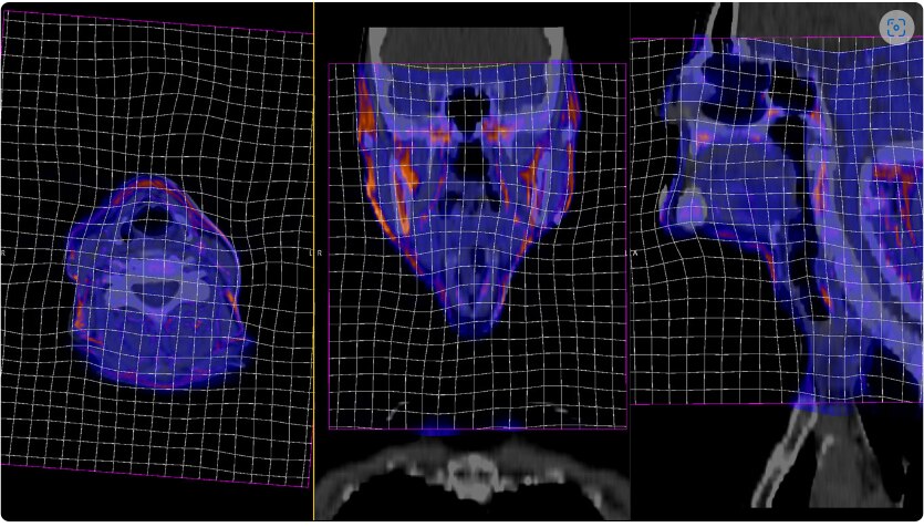 RTxᵀᴹ | GE HealthCare (United States)