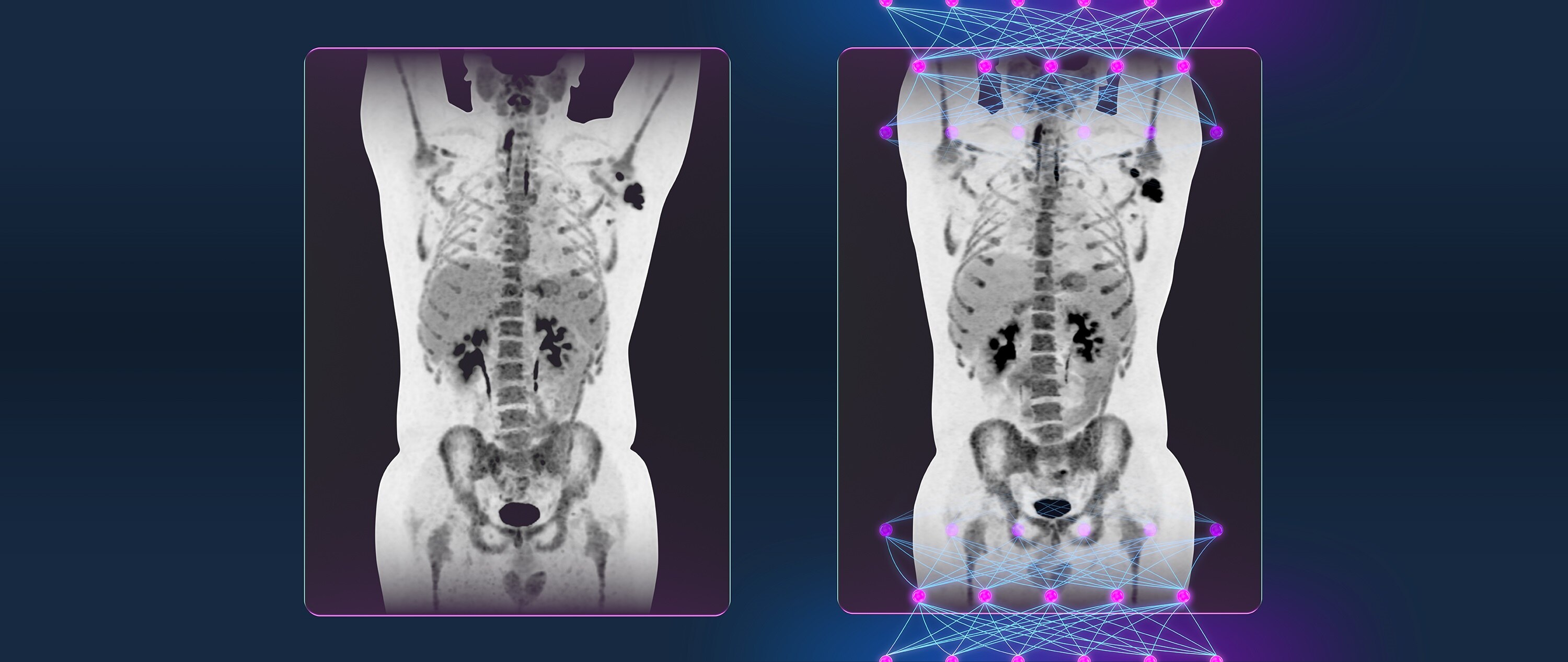 Advancing molecular imaging with deep-learning technology